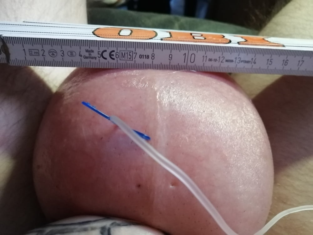 Saline Infusion Scrotum More As 2 L 48 Pics Xhamster
