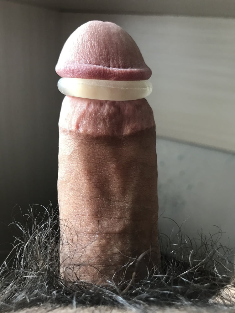 Put A Rubber Ring On The Glans 5 Pics Xhamster 6306